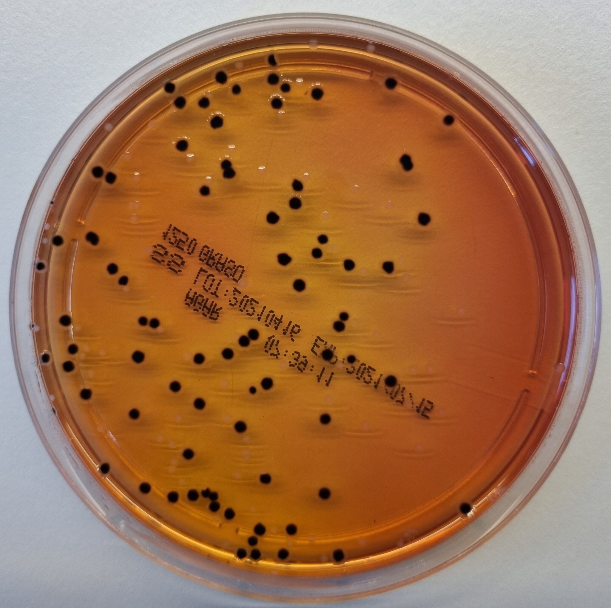 Salmonella Shigella Agar – Zazyro Grup